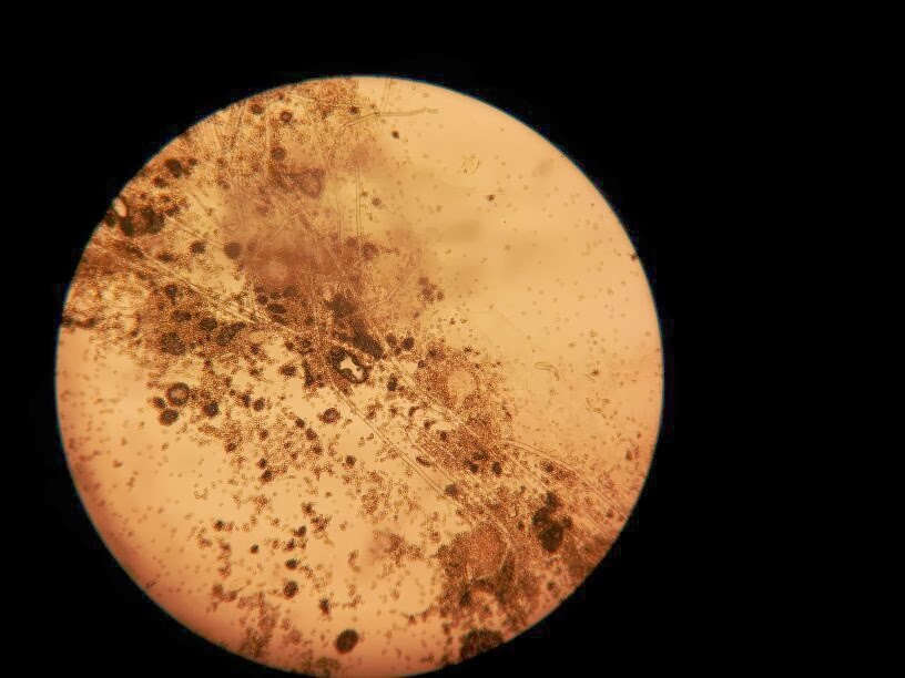 Biologia Humana: Practica de los mohos