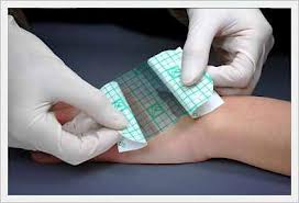 Si Bocah dari Sumbawa: Tahap Pengkajian Keperawatan pada Luka