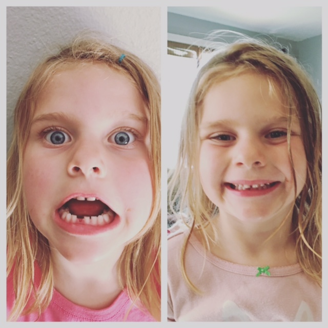 The Life of the Shrimpies: Sam and Ava.: Ava loses her first tooth