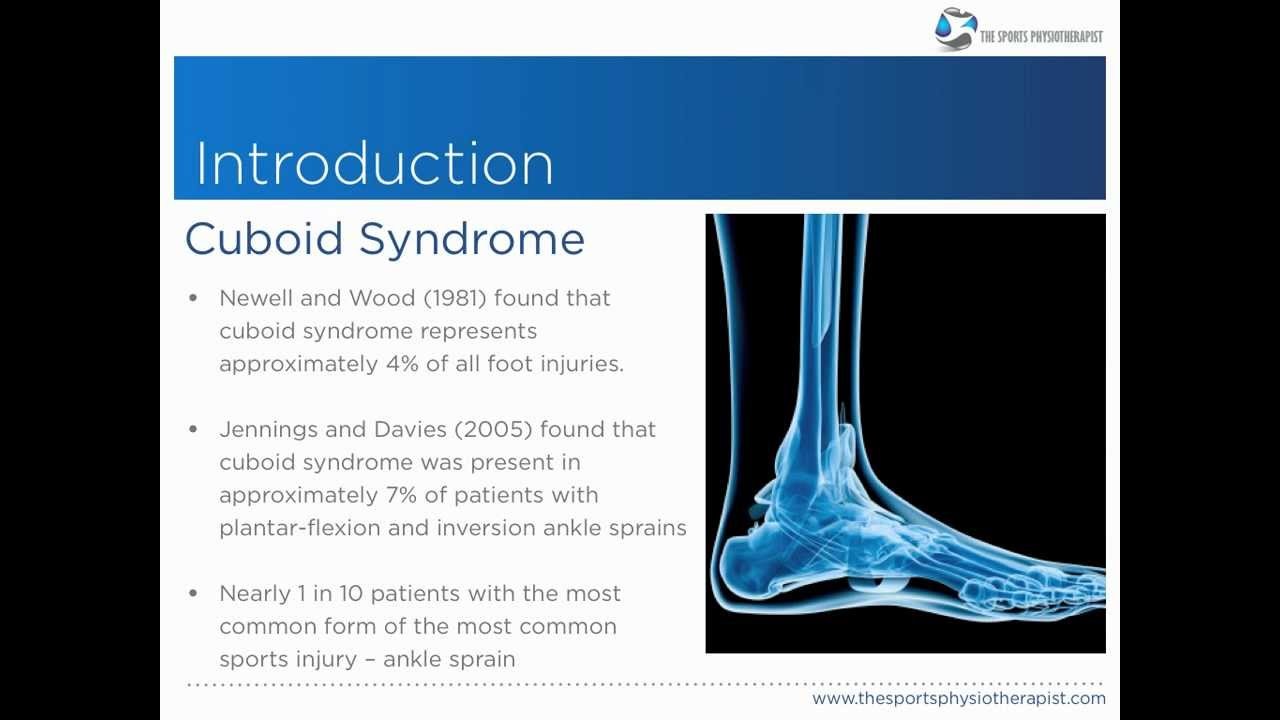 Cuboid syndrome