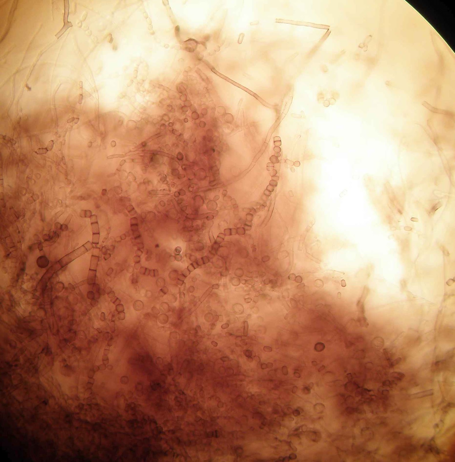 ATLAS MICOLOGIA: SCYTALIDIUM DIMIDIATUM (Neoscytalidium dimidiatum)