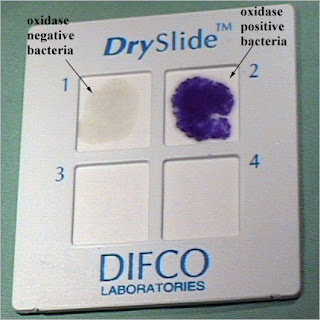 D-Lab Health: Team Nososano: Oxidase test - continued