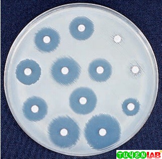 [Microbiology] Atlas of Antimicrobial Susceptibility Testing | Free ...