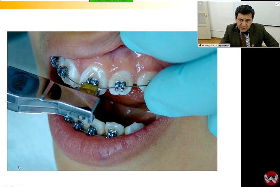 Curva Reversa De Hollemback - RETOEDU