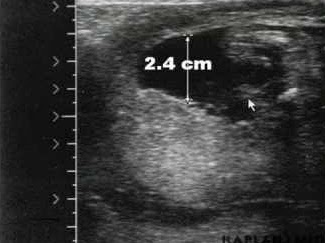 Pelatihan USG Medan: MEMERIKSA DAN MEMONITOR JANIN PADA TRIMESTER KEDUA ...