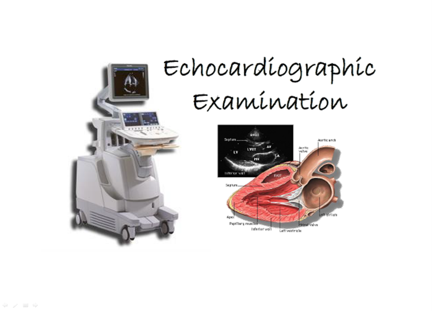 อายุรศาสตร์รพ.สมเด็จพระเจ้าตากสินมหาราช: Echocardiographic examination ...