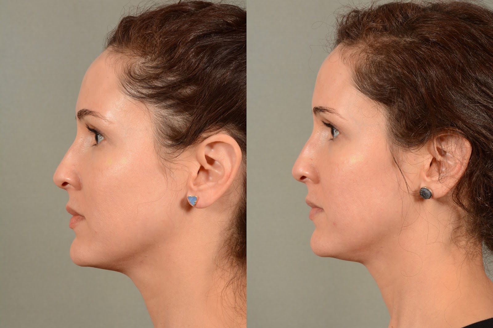 Complection Perfection