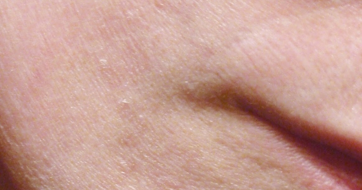 Skin and the Effects of Alcohol