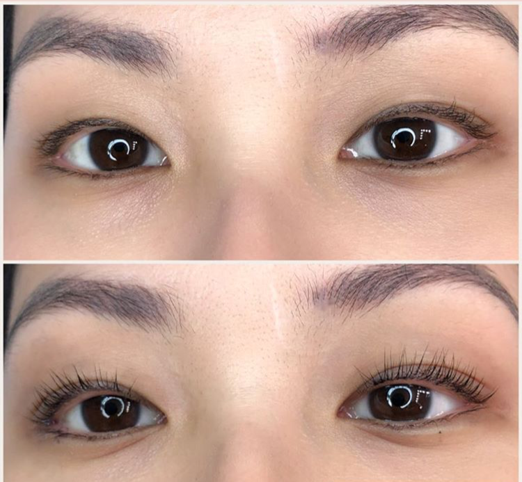 EXPERIENCE | I Got a Yumi Lash Lift! | Cosmetic Proof | Vancouver ...
