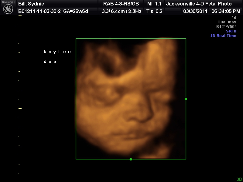 The Baby Bump: Second Trimester