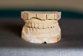 The Daily Floss: Just Flappin' My Gums: Preliminary Impressions and ...