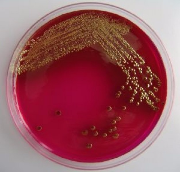 ENDO Agar - Microbiology Laboratory Turkey
