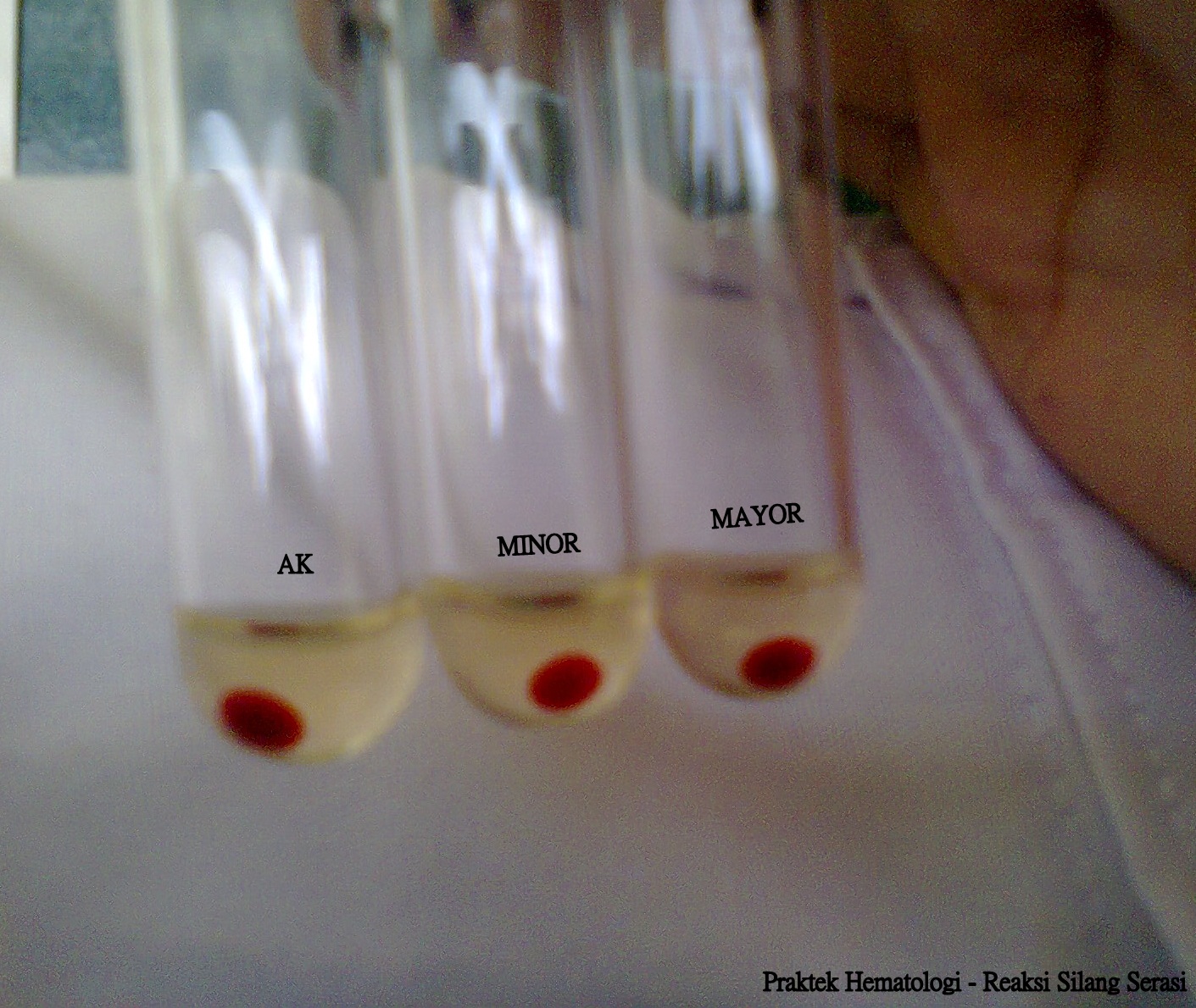 Reaksi Silang Serasi | Analis Kesehatan