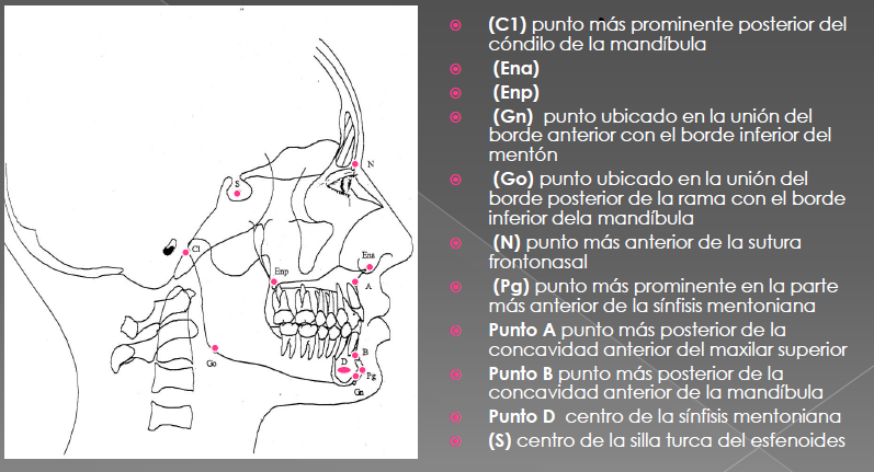 Analisis cefalometricos parte 1: Análisis de Steiner