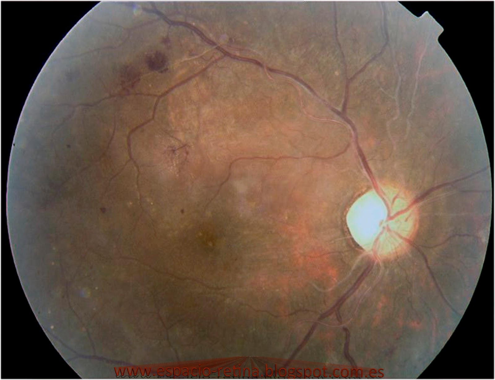 ESPACIO RETINA