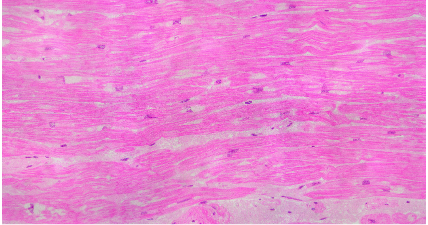 TP Histologie N° 01: le myocarde / l'artère ~ TOP صحة