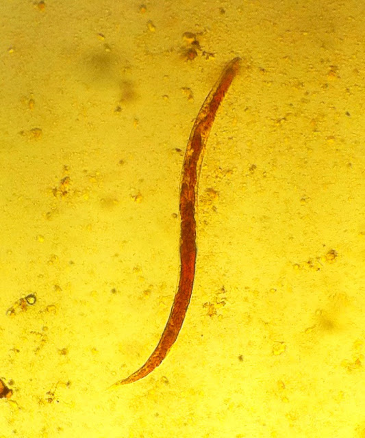 Infection Landscapes: Strongyloidiasis