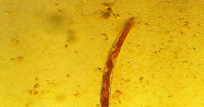 Infection Landscapes: Strongyloidiasis