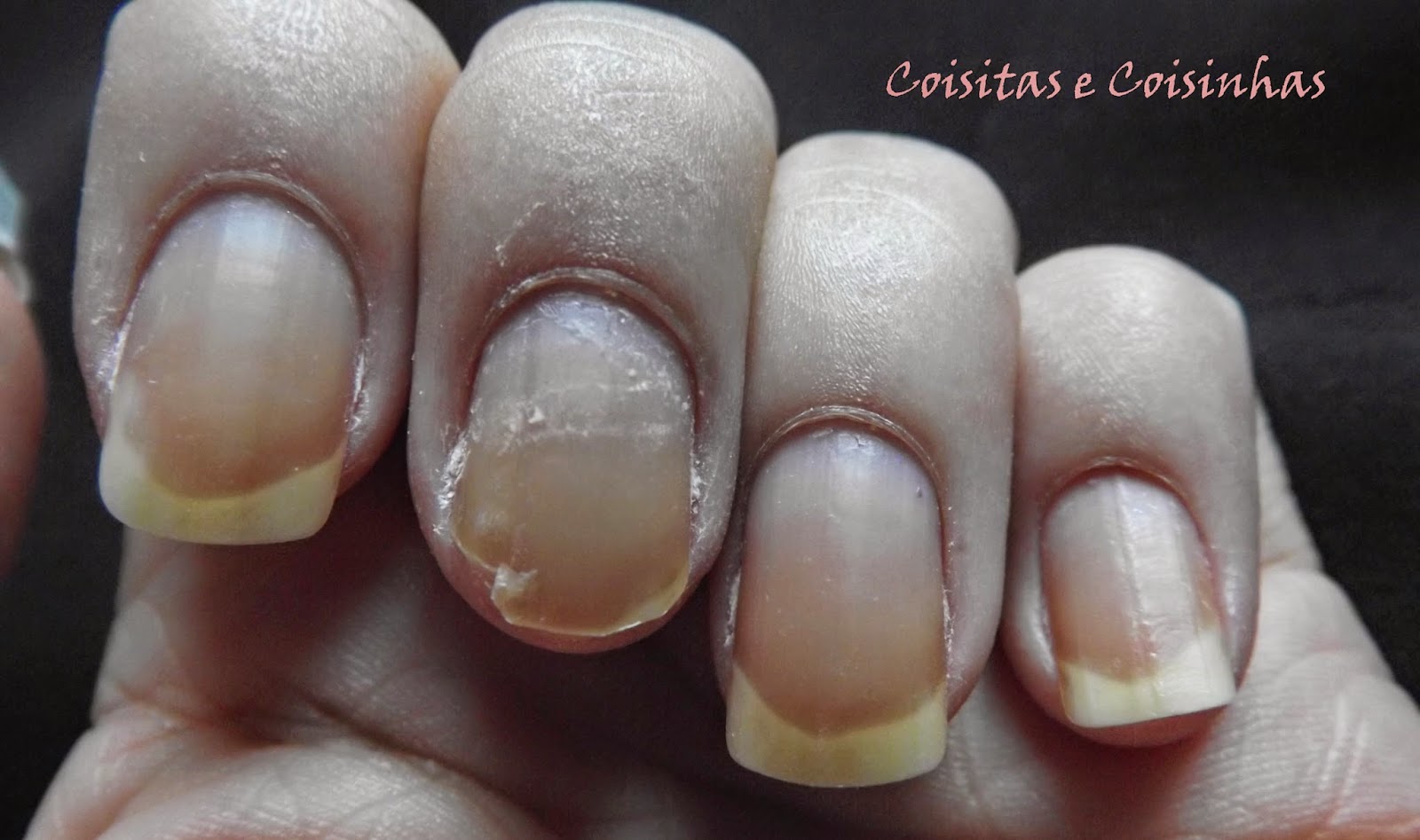Coisitas e Coisinhas: Unhas: disfarçando a unha quebrada