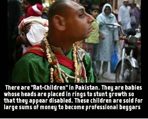 Did you know that there are "Rat-Children" in Pakistan. They are babies ...