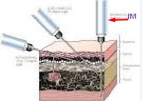 Nursing guidelines for IM injections.