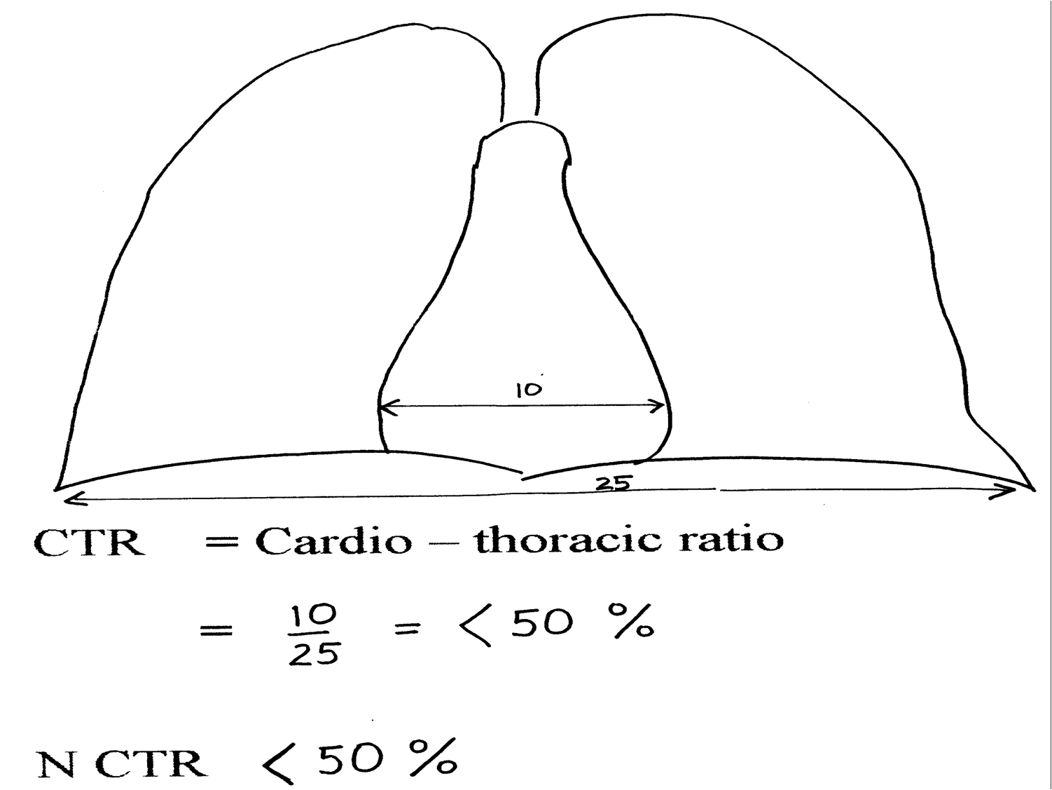 dioramaduniaku: Membaca Rontgen Toraks Normal