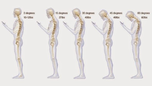 Common Postural Deviations