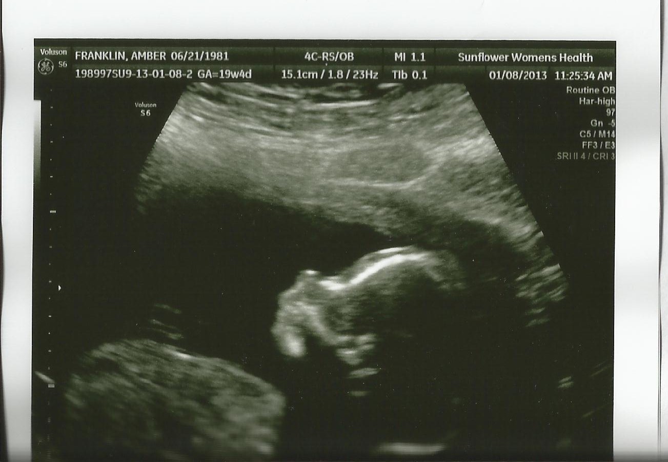 Together, we make a family.: Baby Boy Sonogram