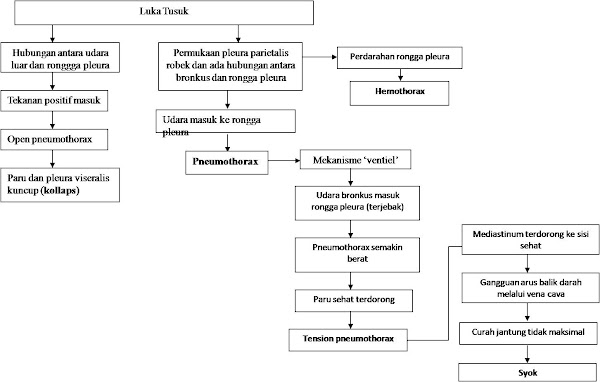 Catatan kecil: Keperawatan gawat darurat : pathway trauma dada