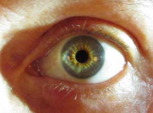 Gurney Journey: Caustics inside eyes