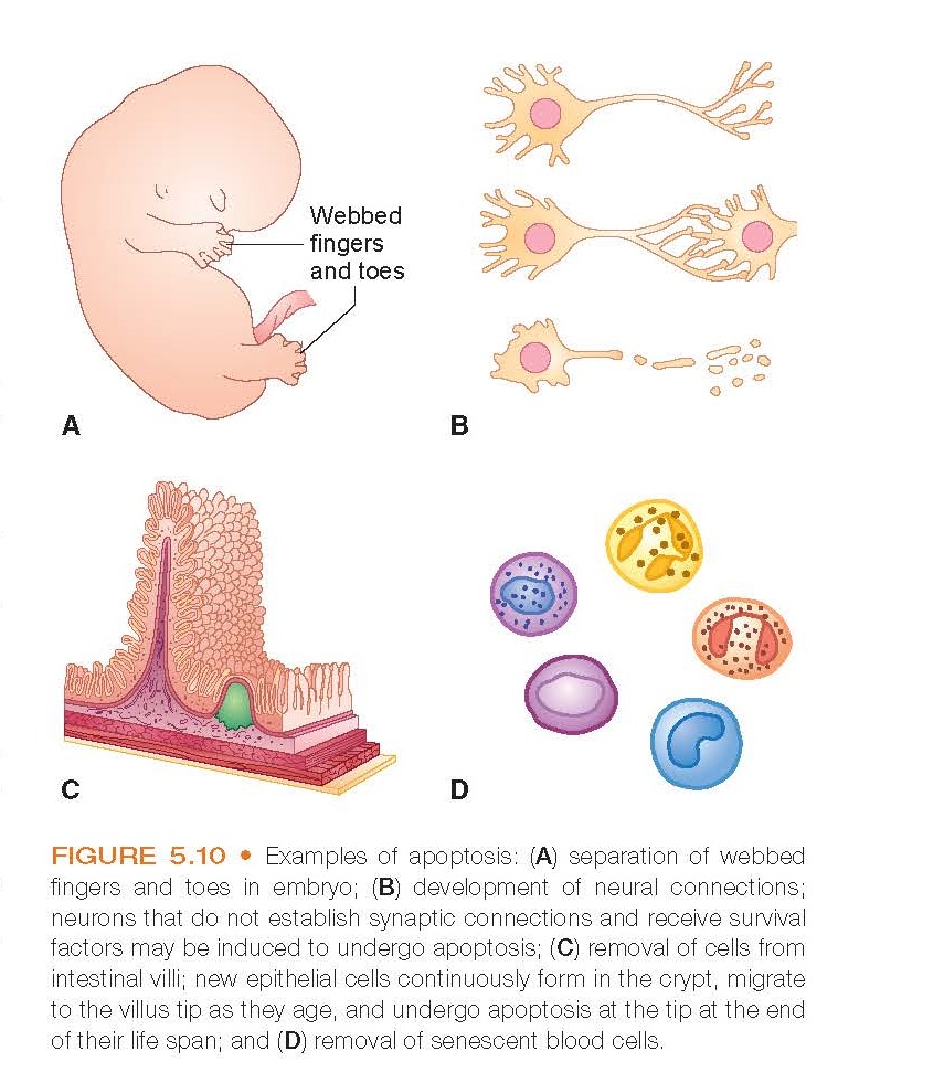 Reversible Cell Injury and Cell Death - pediagenosis