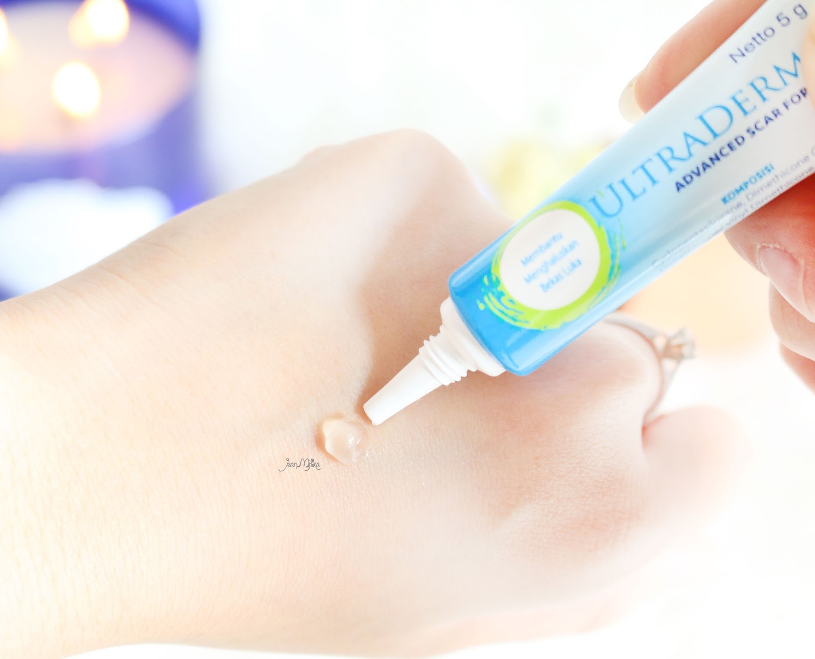 Review Ultraderma Advanced Scar Formula | Jean Milka