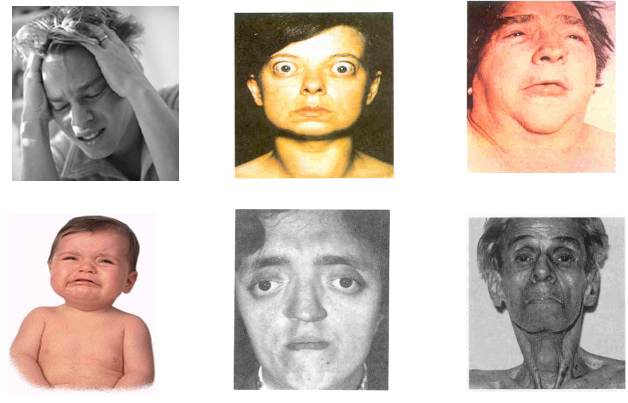 Enfermería Básica UCV : EXAMEN FÍSICO DE CABEZA Y CUELLO SEG 2015