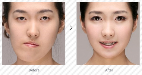 JP Dentofacial and Implantology Clinic: Is There Beauty In Face Symmetry?