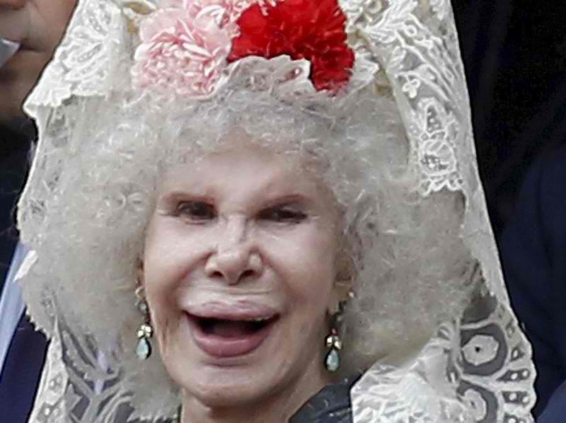 The Duchess Of Alba Plastic Surgery