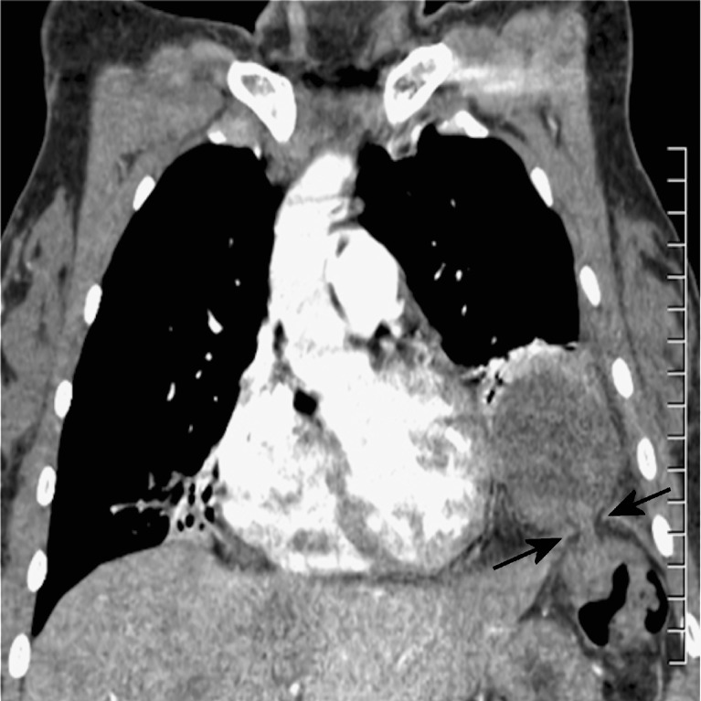 icupearls.org Archive: November 2017