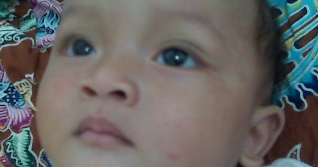 KRiSeLeN FaMiLy: Roseola Infantum