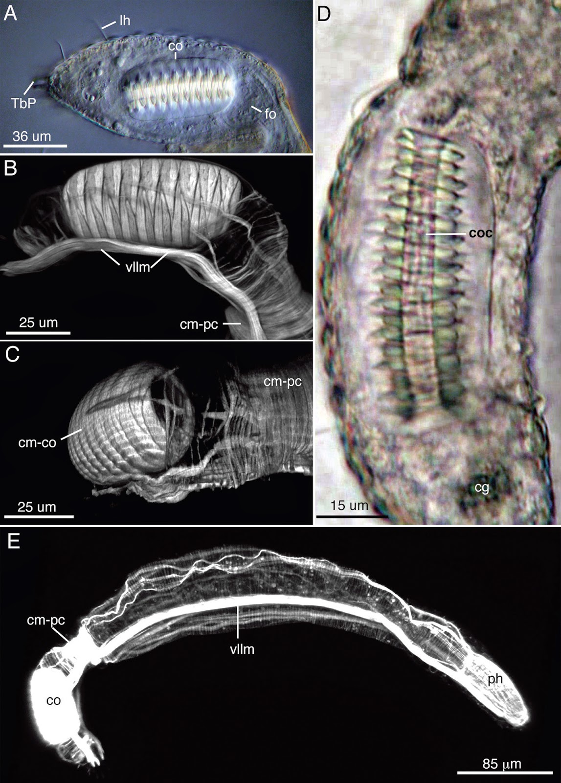 Sciency Thoughts: A new species of Gastrotrich from the Atlantic coast ...