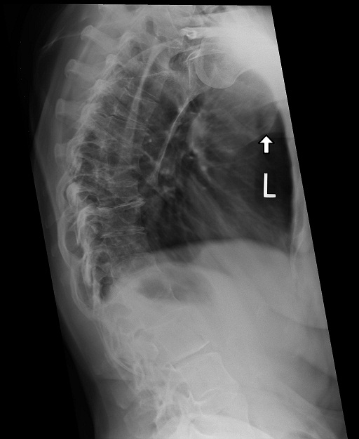 Bionica: The Making of a Metal Momma: December 2011