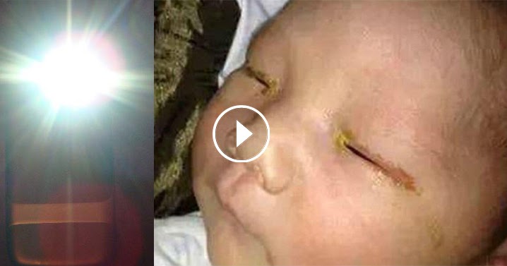 A Three-Month-Old Baby was Left Blind in One Eye After a Family Friend ...
