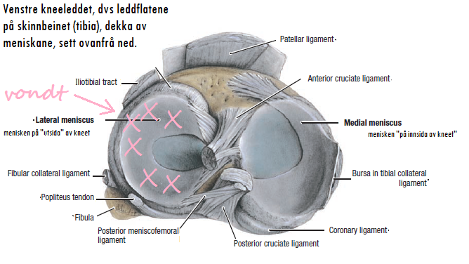 I treningsmodus: på trening og på tur.: Ein irritert menisk, men eg er ...