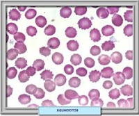 Realizar una Biometría Hemática
