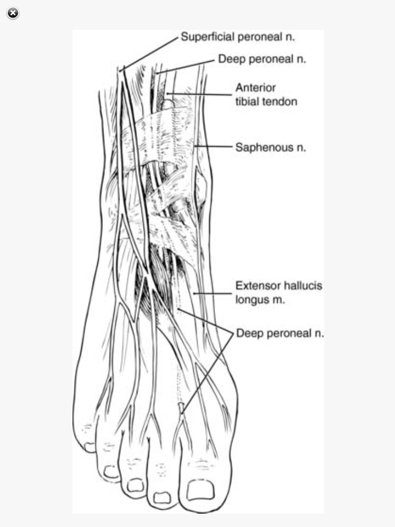 SRNA Daily Review: REGIONAL ANESTHESIA: BLOCKS