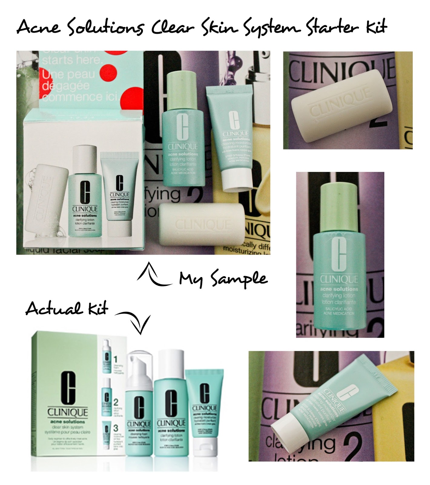 Products Journal: Clinique - Acne Solutions Clear Skin System Starter Kit