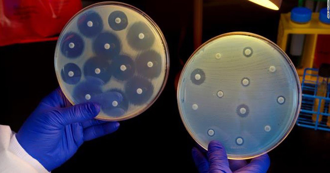 Medical Laboratory and Biomedical Science: CRE may be spreading more ...