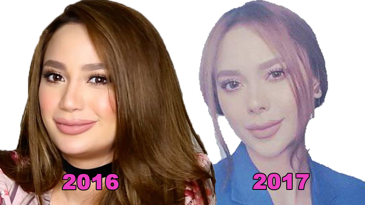 Pinoy Top List: Is Arci Munoz addicted to plastic surgery?