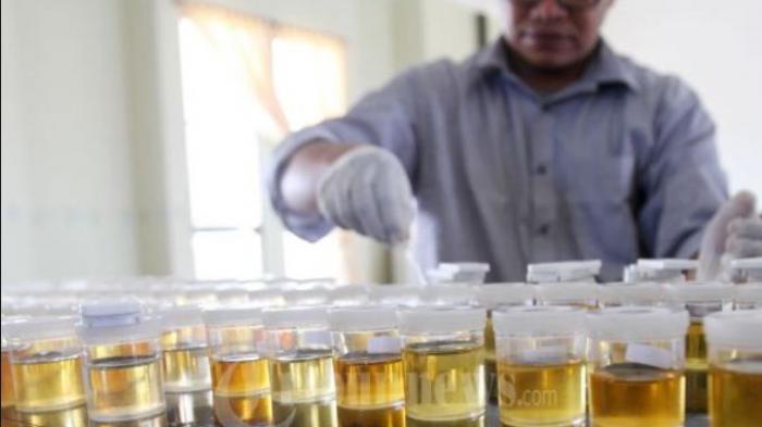 SFN NETWORKS: PEMERIKSAAN PROTEIN URIN METODE ASAM SULFOSALISILAT 20%