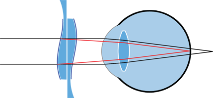 The TechOptom: New adaptive optic slides into view
