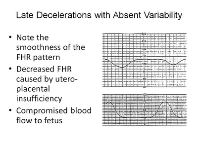 MBBS Medicine (Humanity First): Assessment of Fetal Well-being