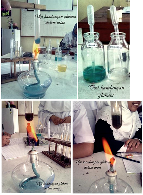 Uji Kandungan Urin ~ Advanced Insight